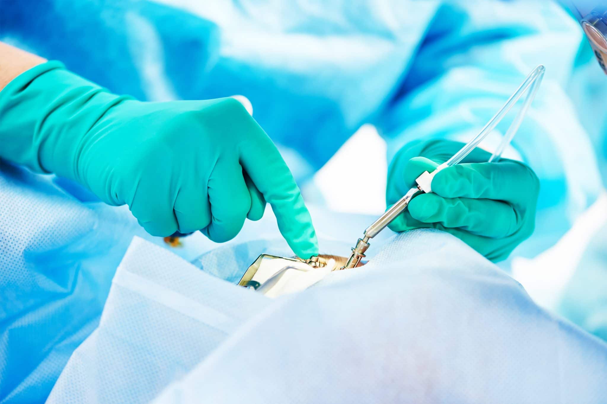 Retina Surgery Options and Recovery | Eye Center of Texas